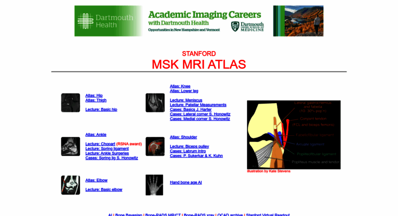 Access xrayhead.com. Stanford MSK MRI Atlas (c) 2020